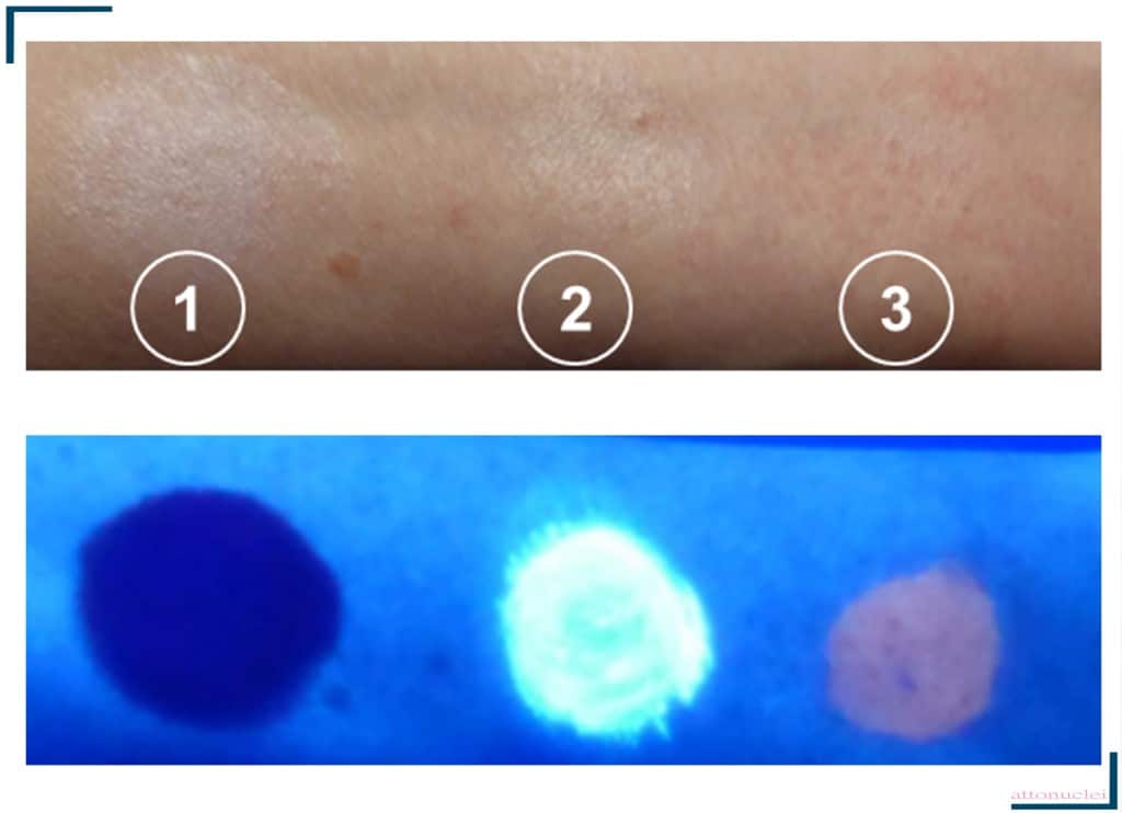 NANOBIOTECHNOLOGY – Attonuclei